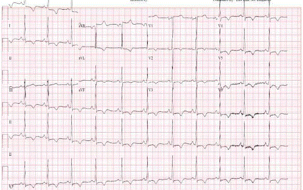 Yamaguchi’s Disease in African American Patient: A Case Report and ...